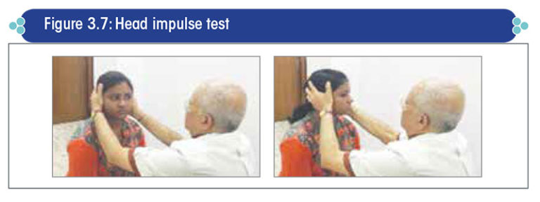 Evaluation of the vestibular system by clinical tests and by ...